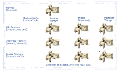 Digital Vertbral Assessment (DVA) | Te Awamutu & Auckland