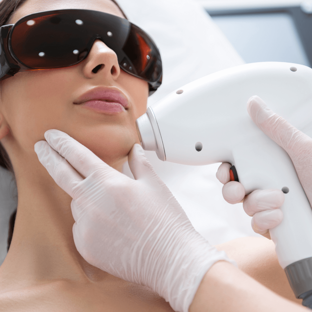 IPL TREATMENT in Timaru | Divine Wellbeing | Divine Wellbeing