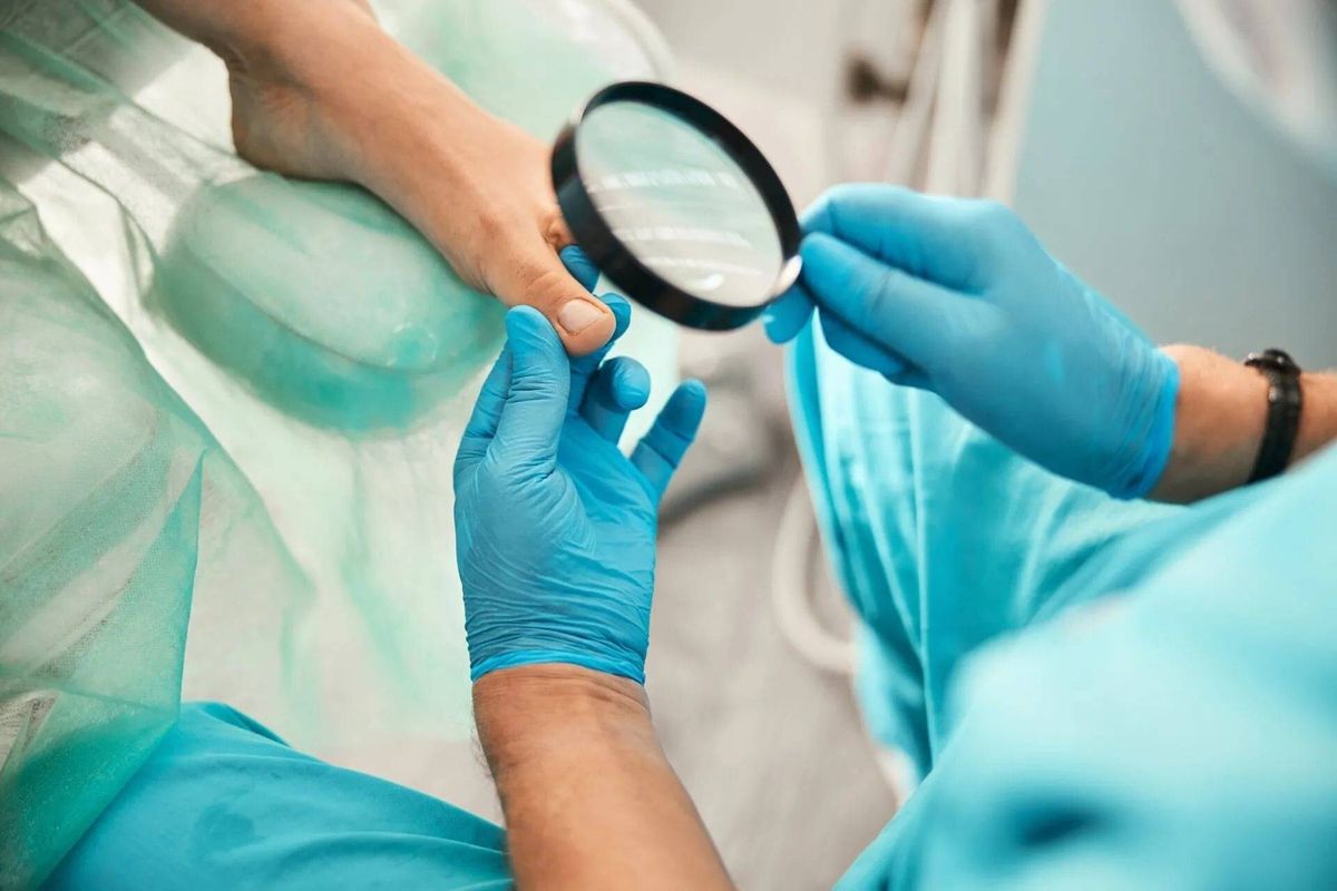 Lifted Nail PLATE | Cosmetic Nail Solutions