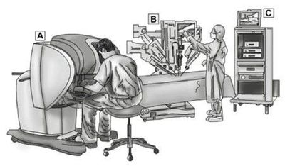 TORS System & Procedure | ENT Central
