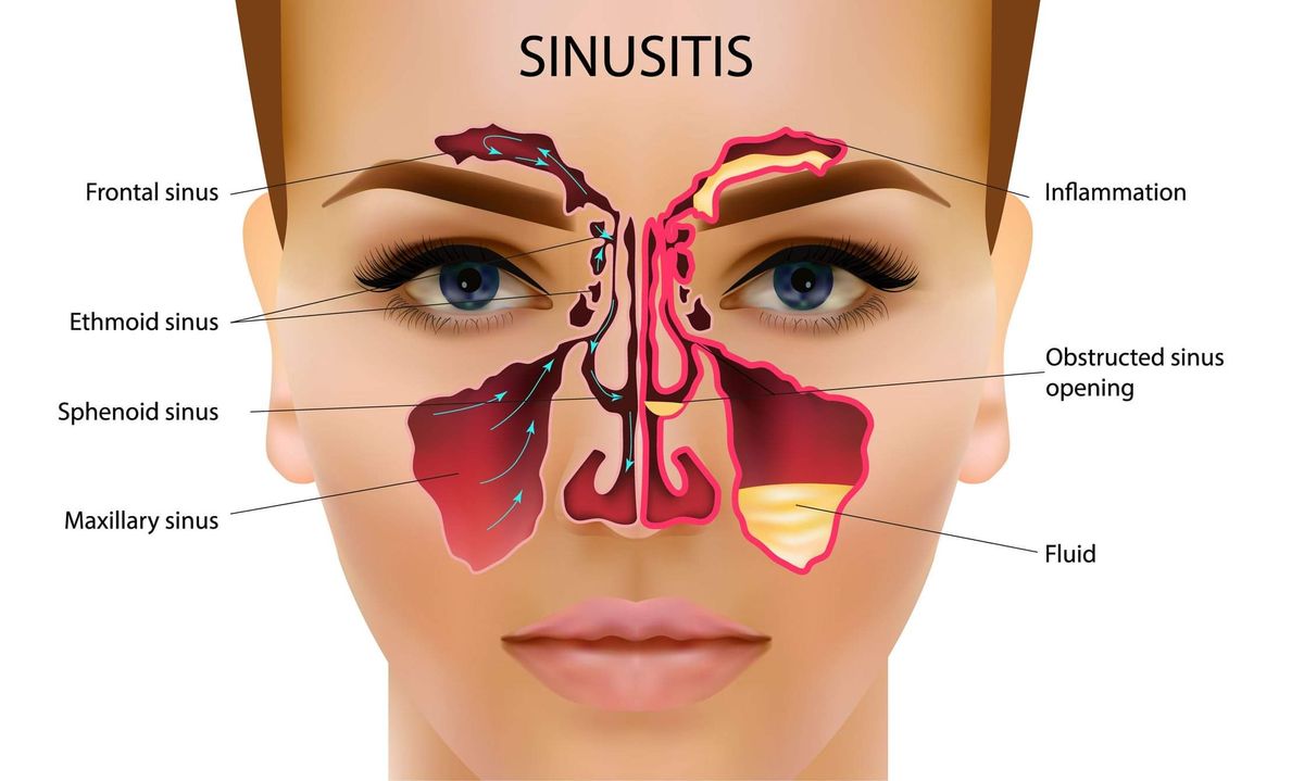 Functional Endoscopic Sinus Surgery | ENT Central