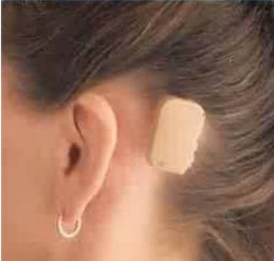 Bone Anchored Hearing Aid (BAHA) Surgery | ENT Central